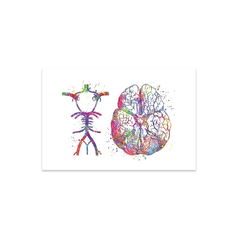 Circle Of Willis Print On Acrylic Glass by Genefy Art - Overstock ...
