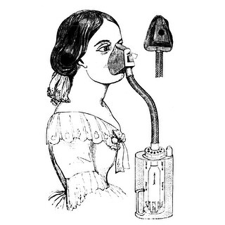 Chloroform Inhaler 1858. /Na Chloroform Inhaler. Illustration From On ...
