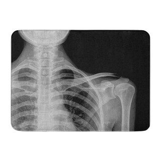 Adult X Rays Of The Painful Injury Shoulder Joint Dislocation Doormat ...