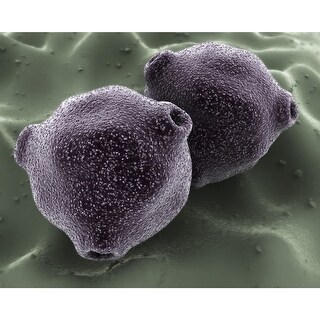 Microscopic View Of Birch Tree Pollen. Birch Tree Pollen Is Considered ...