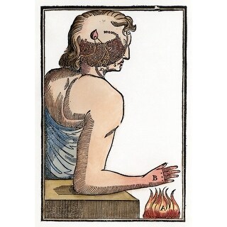 Descartes Reflex 1664. /Ndiagrammatic Engraving Of The Reflex Action As ...